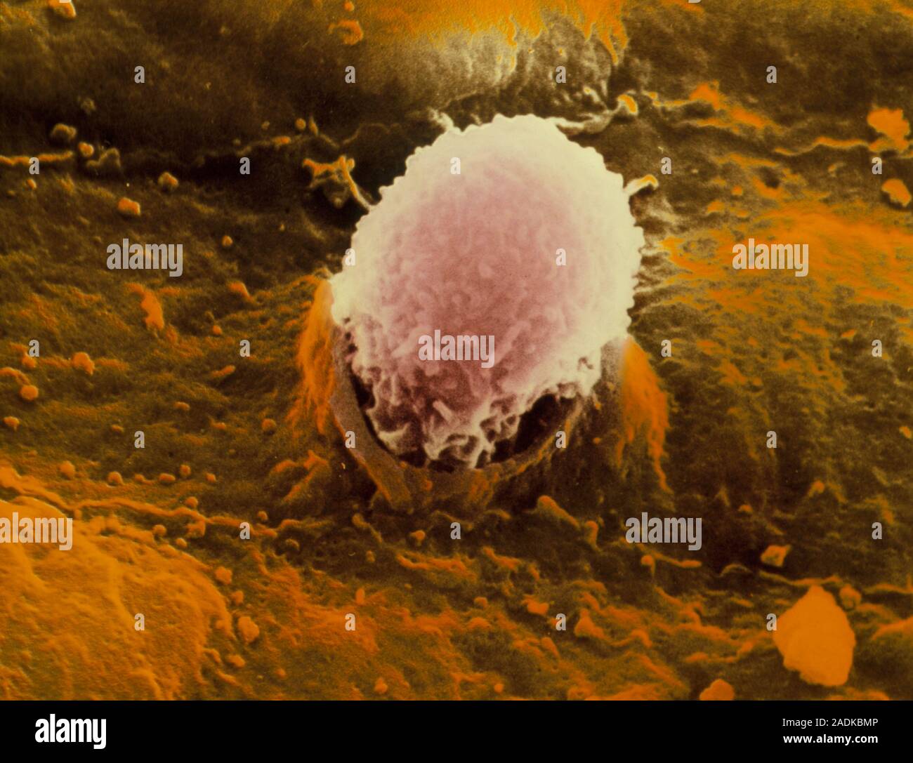 False-colour scanning electron micrograph of a white blood cell ...