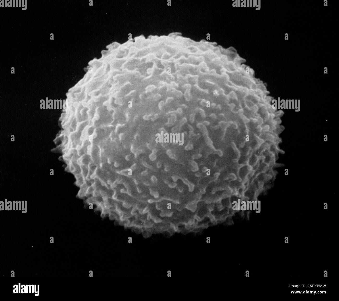 Scanning electron micrograph of a normal, peripheral, blood leucocyte ...