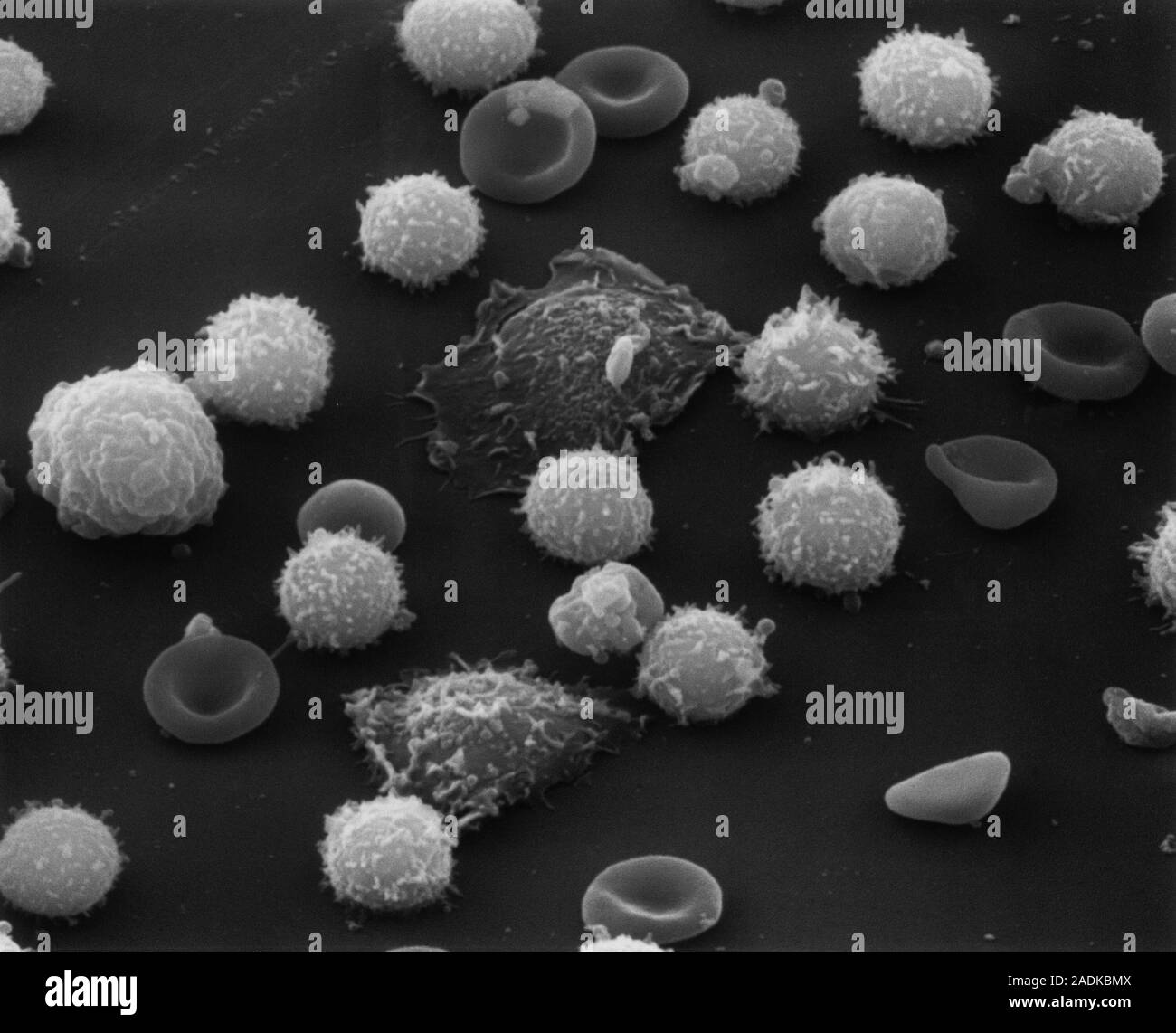 Scanning electron micrograph of a field of normal, peripheral, blood ...