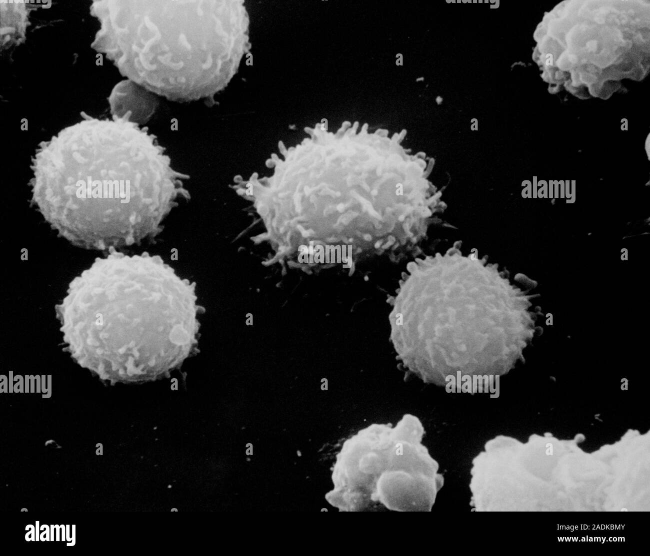 Scanning electron micrograph of a field of normal, peripheral, blood ...