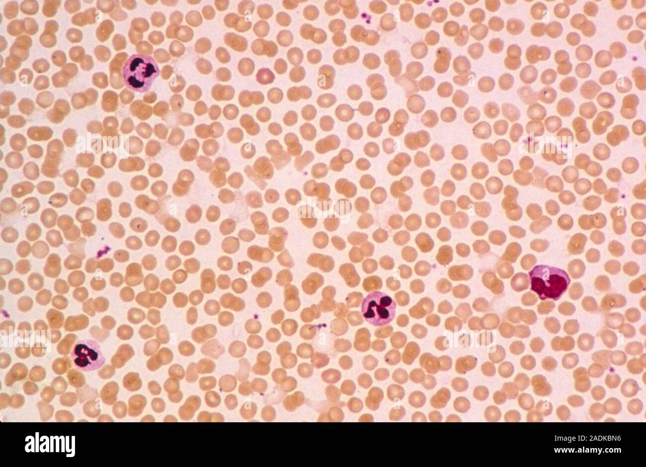 Light micrograph of a sample of normal human blood, showing numerous ...