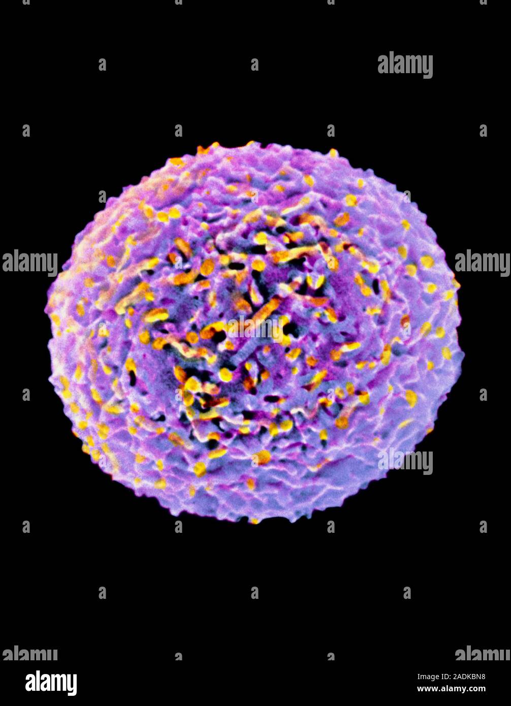 False-colour scanning electron micrograph of a neutrophil, the most ...