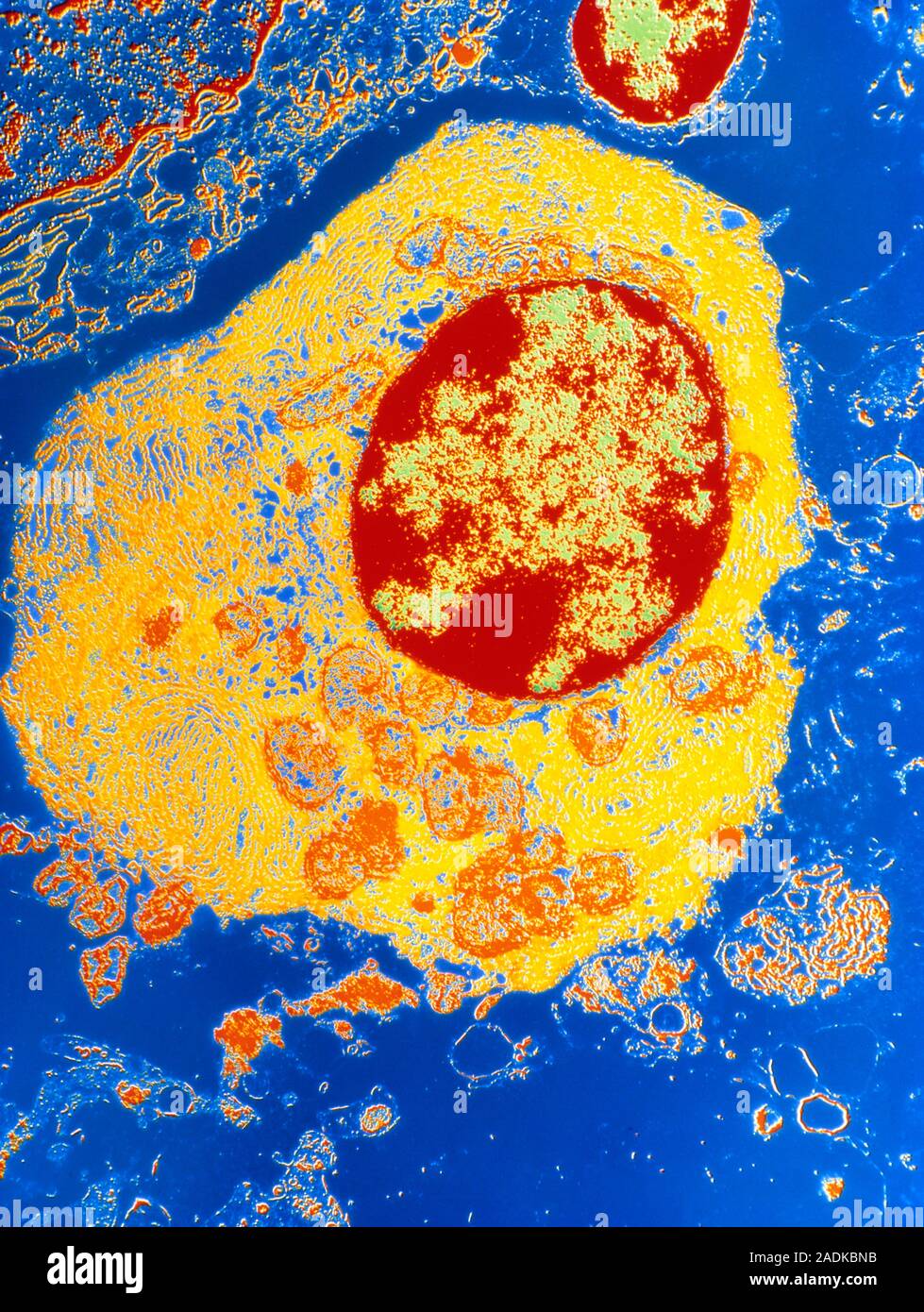 False-colour transmission electron micrograph of a plasma cell from a ...