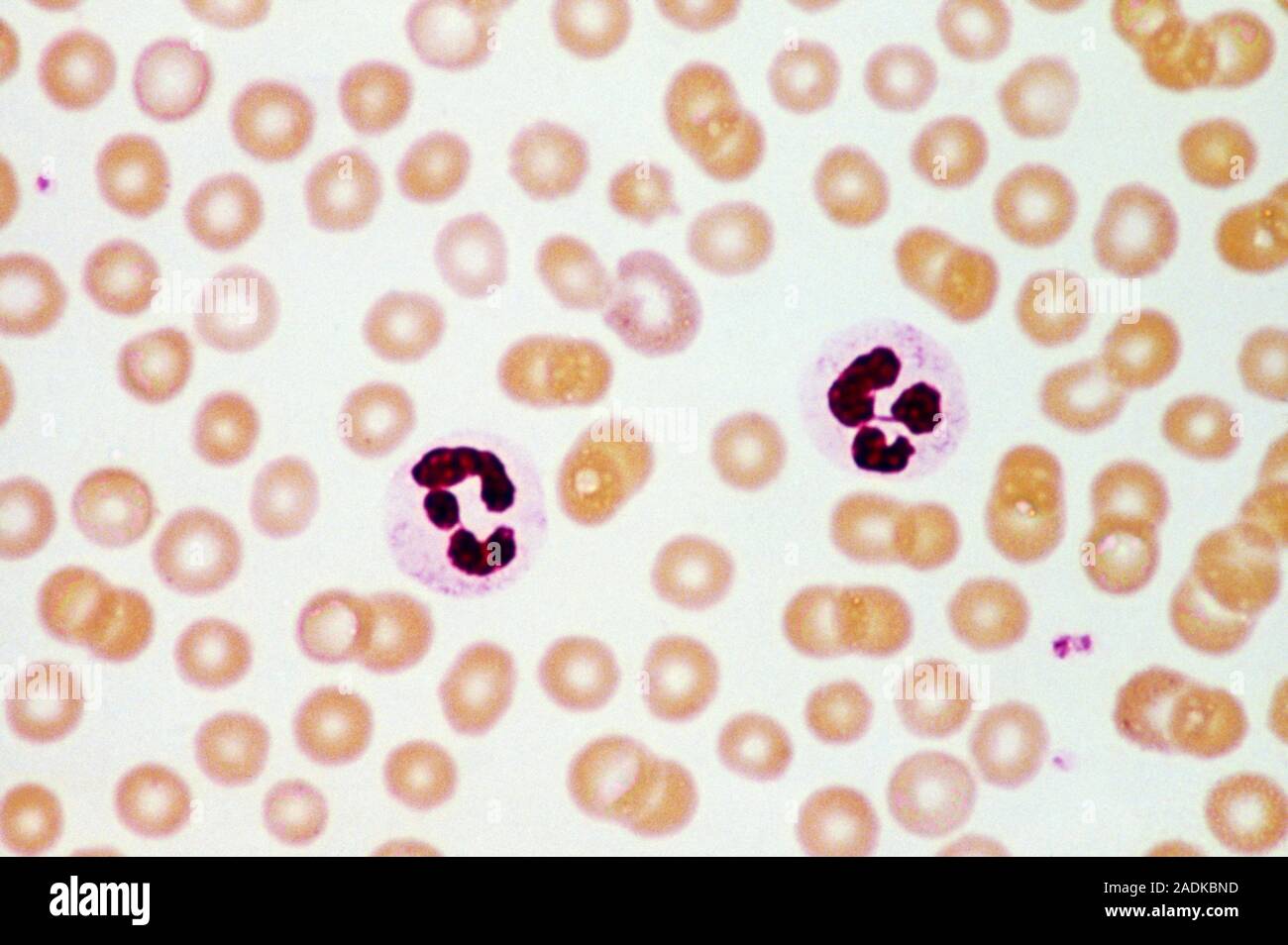Light micrograph showing two neutrophils, the most common type of ...