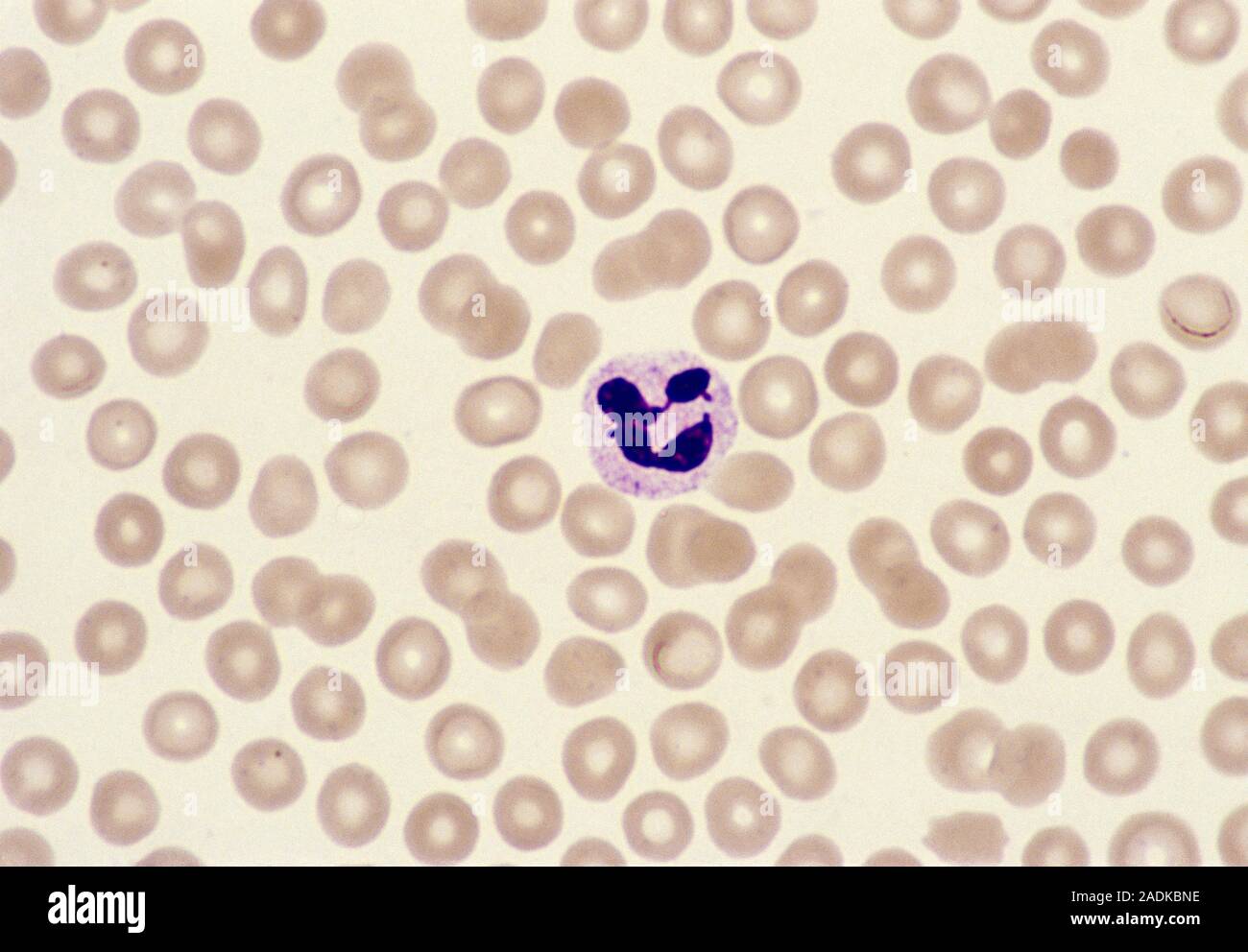 Light micrograph of a neutrophil, the most common type of leucocyte ...