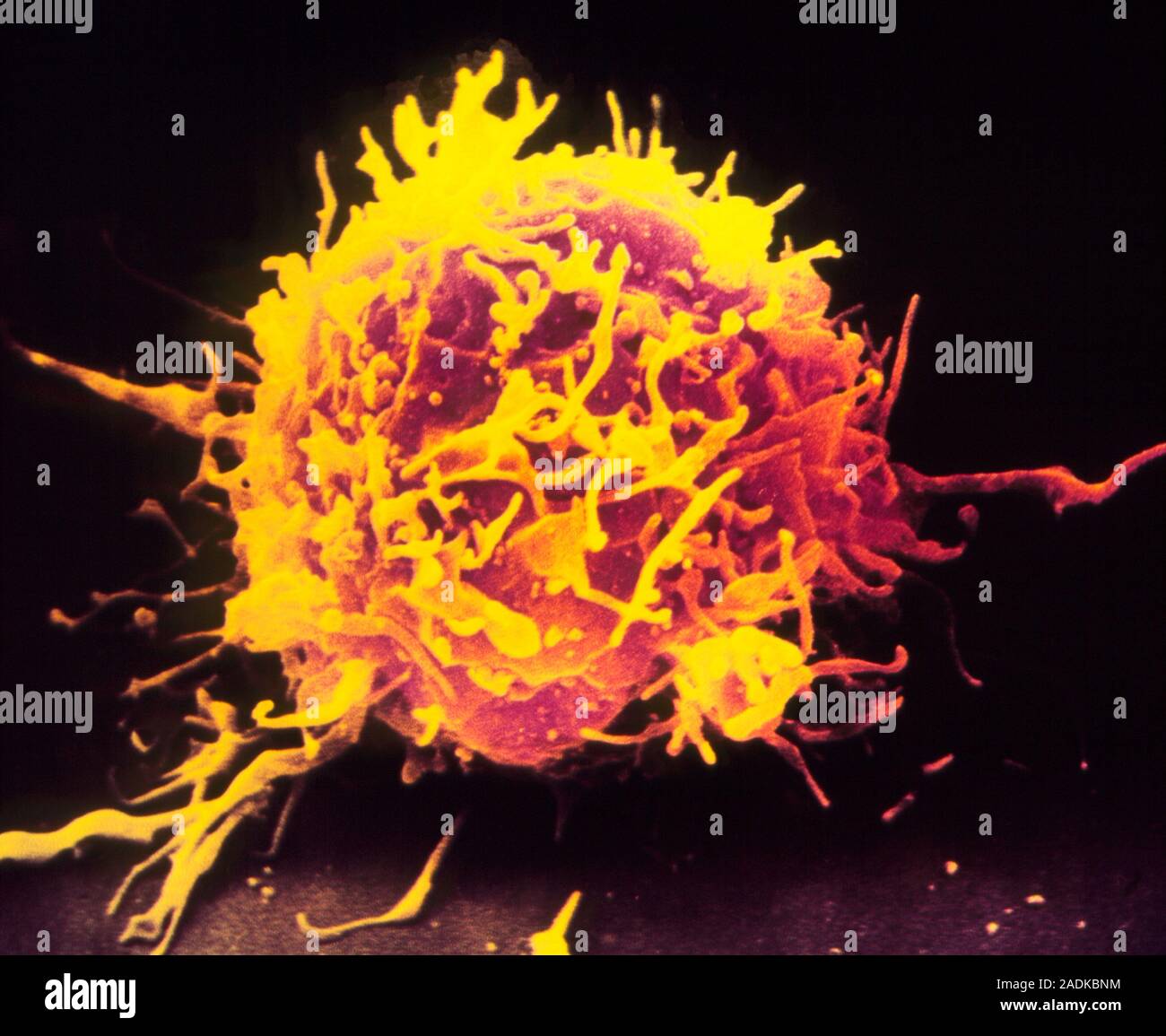 Coloured scanning electron micrograph of a normal T-lymphocyte, a type ...