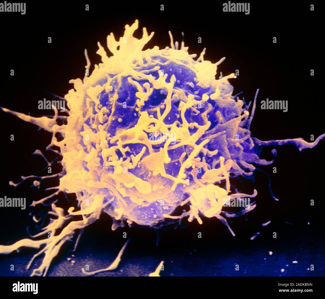 Coloured scanning electron micrograph of a normal T-lymphocyte, a type ...