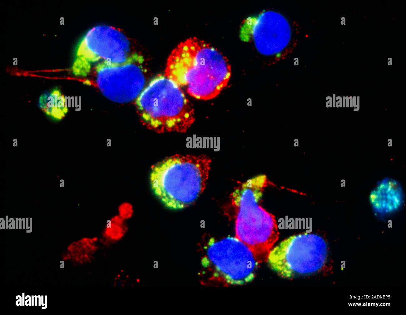 Natural killer (NK) cells. Immunofluorescent light micrograph of human ...