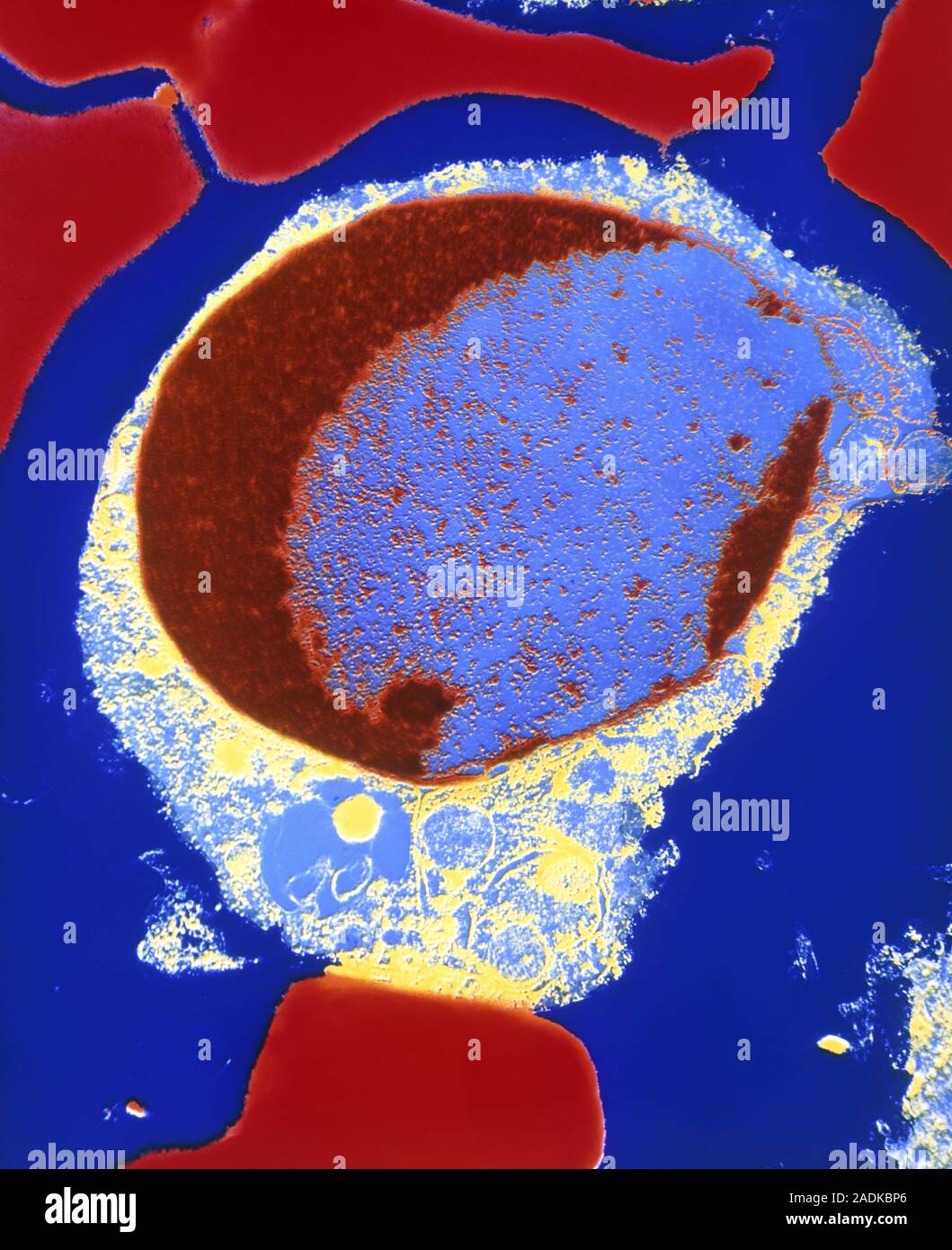 Apoptosis Coloured Transmission Electron Micrograph Tem Of A White