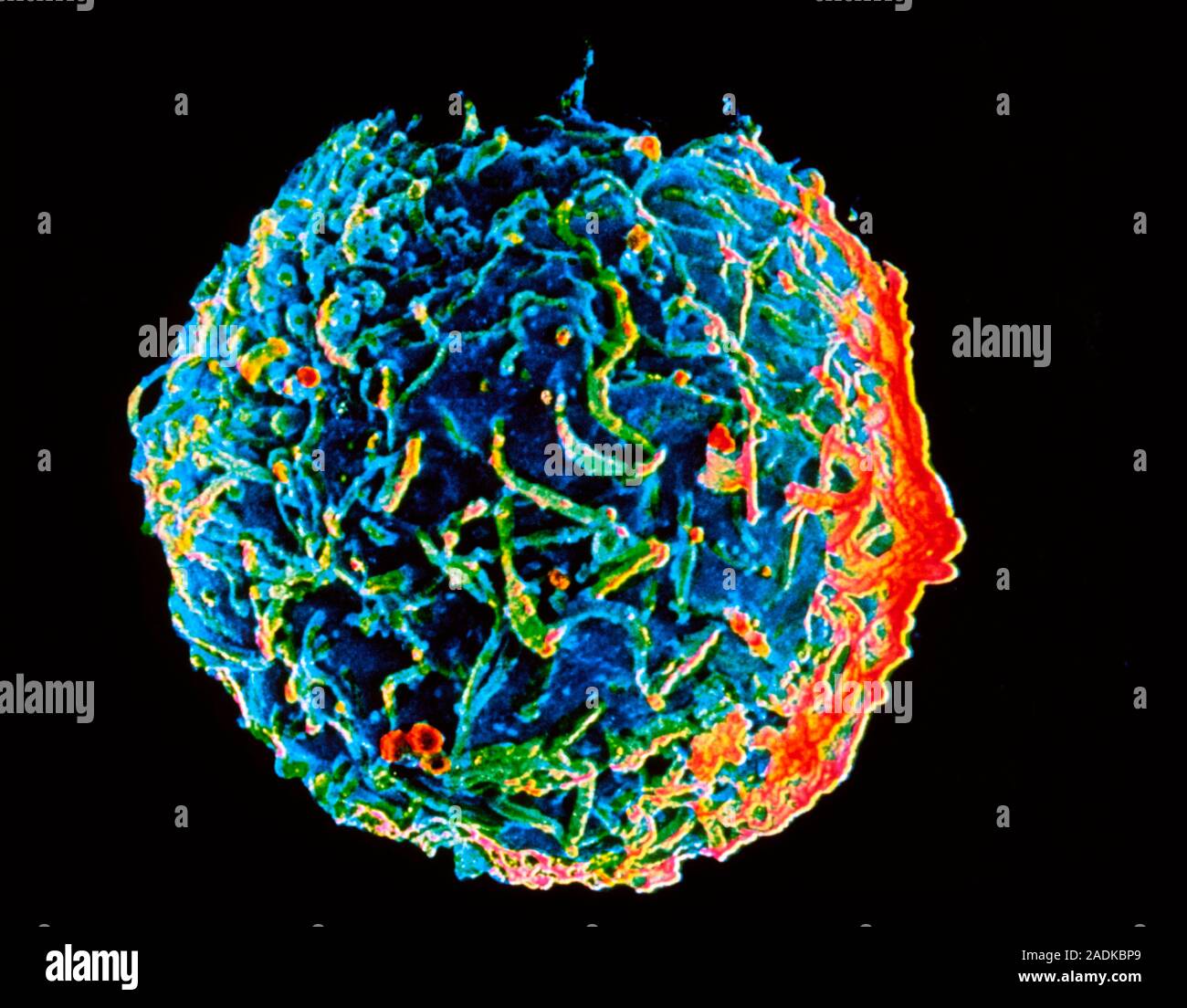 B-lymphocyte. Coloured scanning electron micrograph of a B-lymphocyte ...