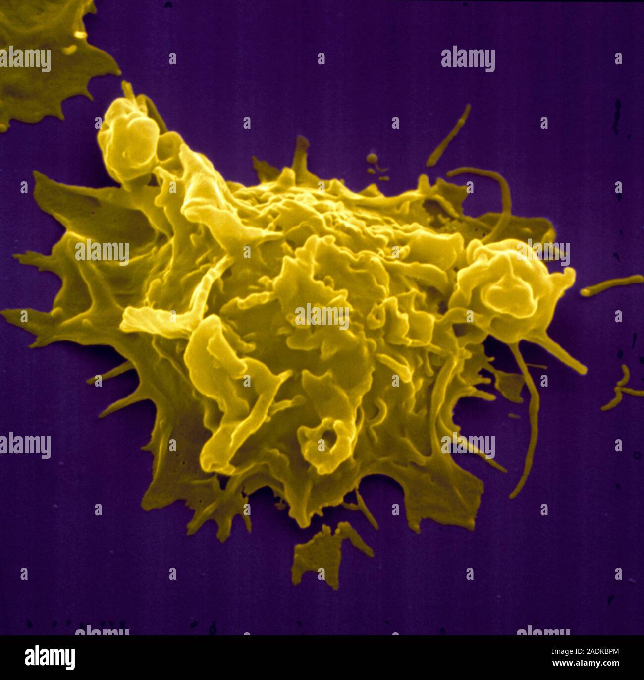 Natural killer cell. Coloured Scanning Electron Micrograph (SEM) of a ...