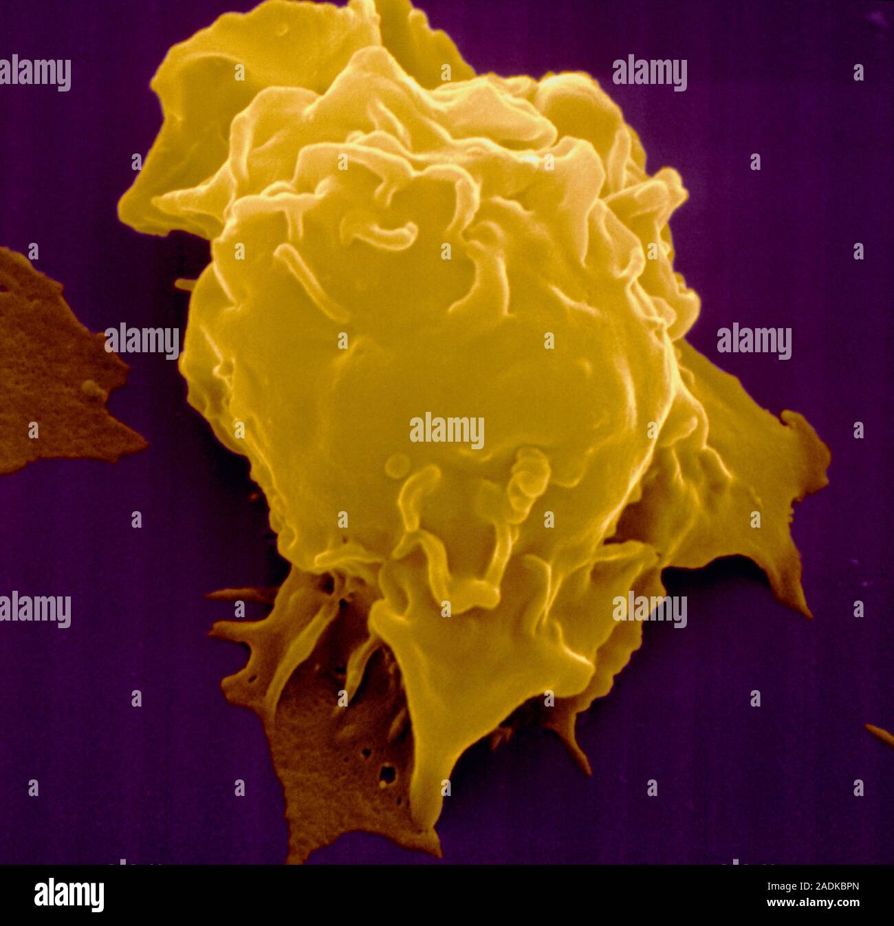 Natural killer cell. Coloured Scanning Electron Micrograph (SEM) of a ...