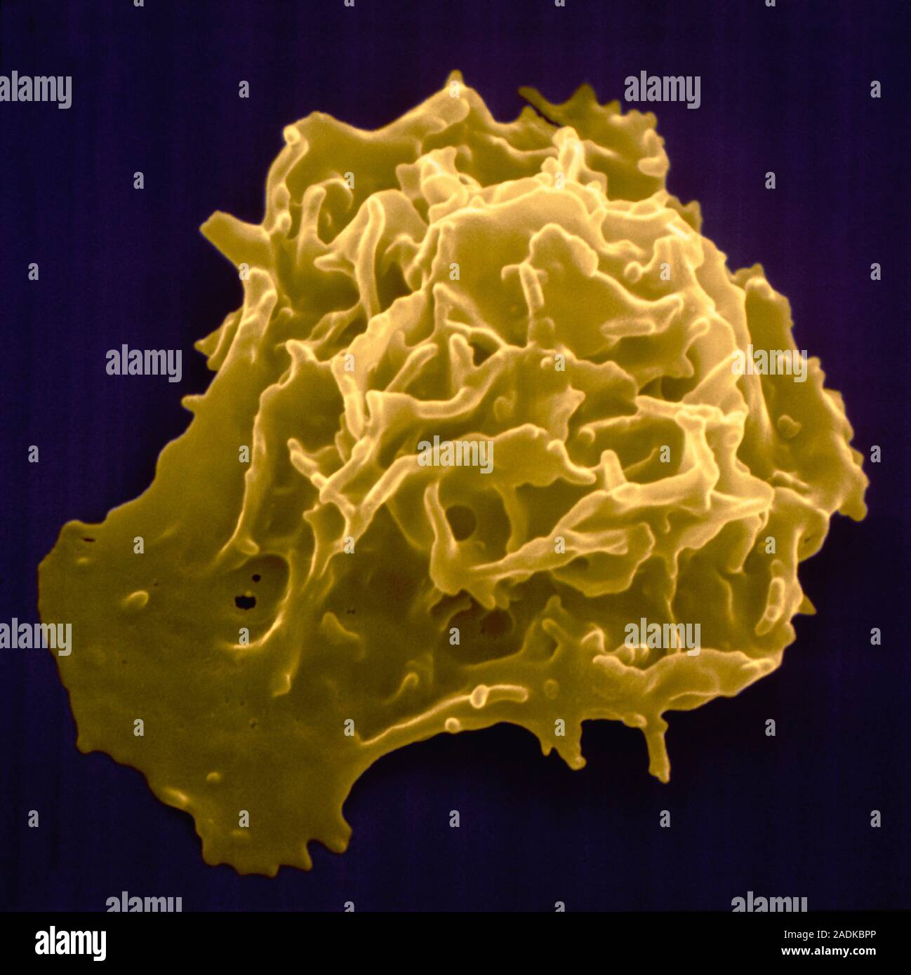 Natural killer cell. Coloured Scanning Electron Micrograph (SEM) of a ...