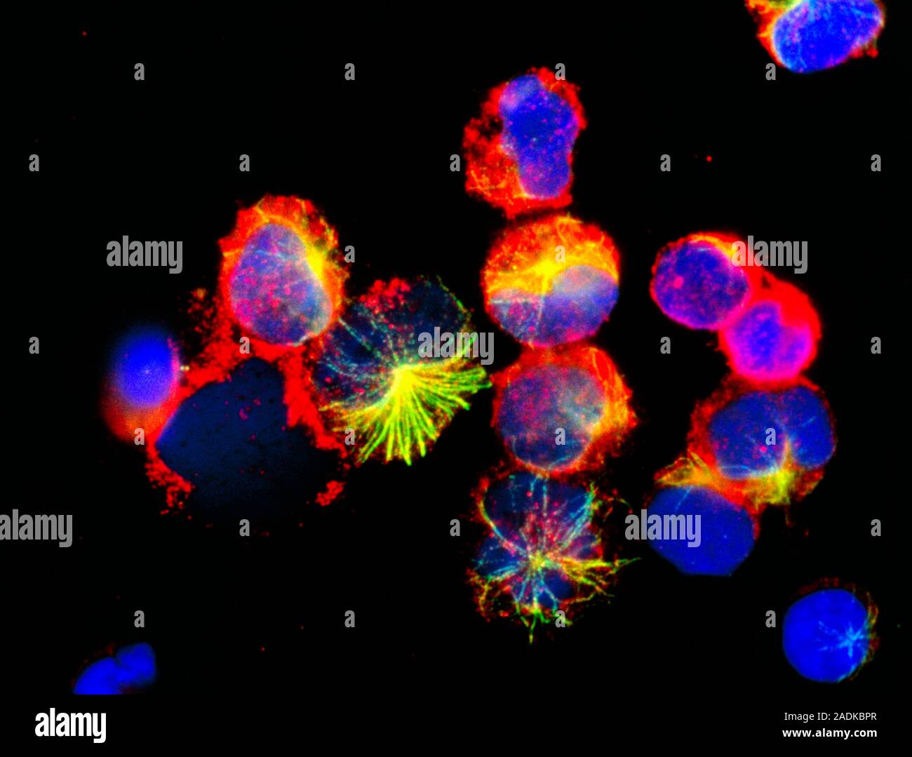 Natural killer cell. Immunofluorescent light micrograph of human ...