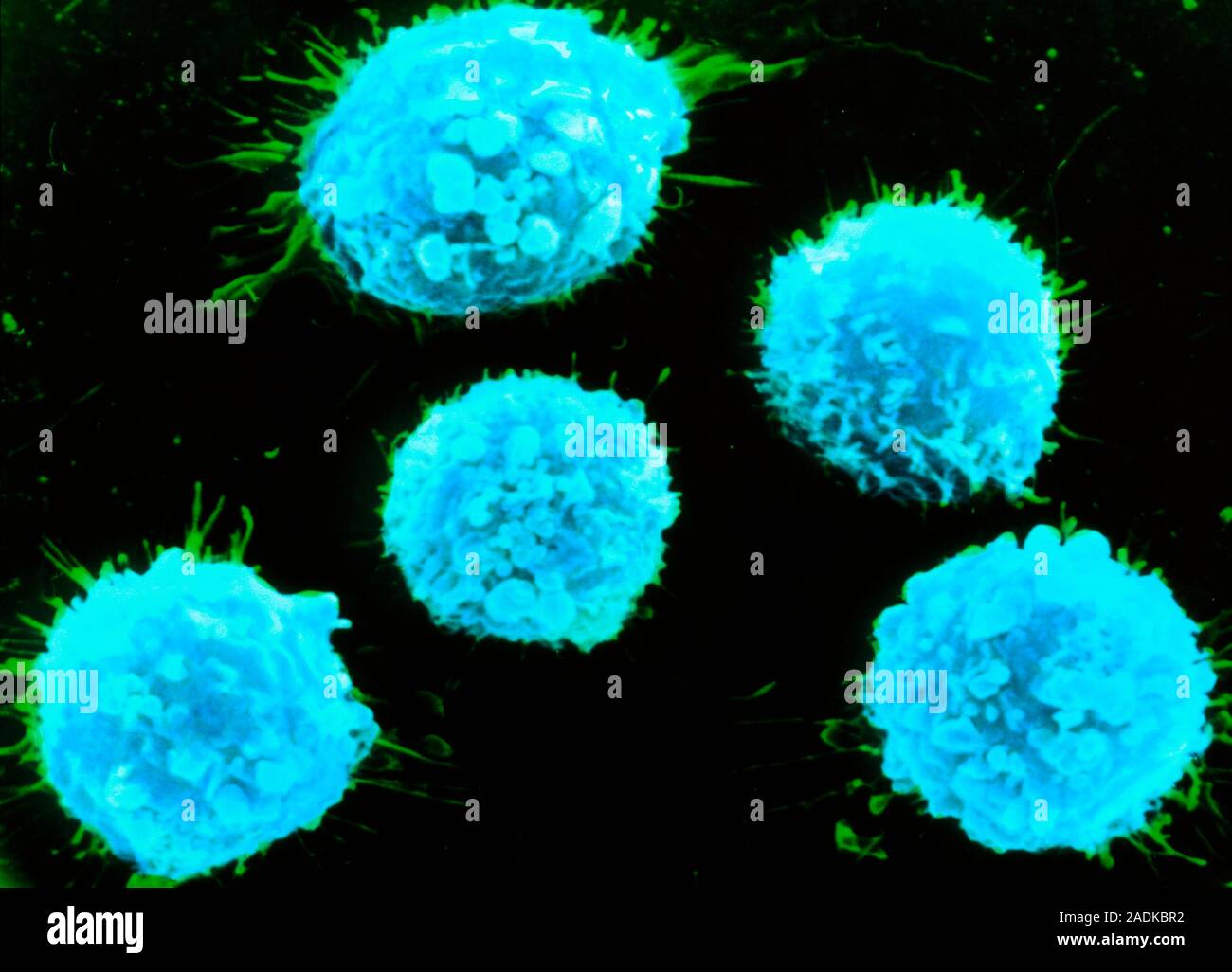 B-lymphocyte. Coloured Scanning Electron Microgr- aph of a group of B ...