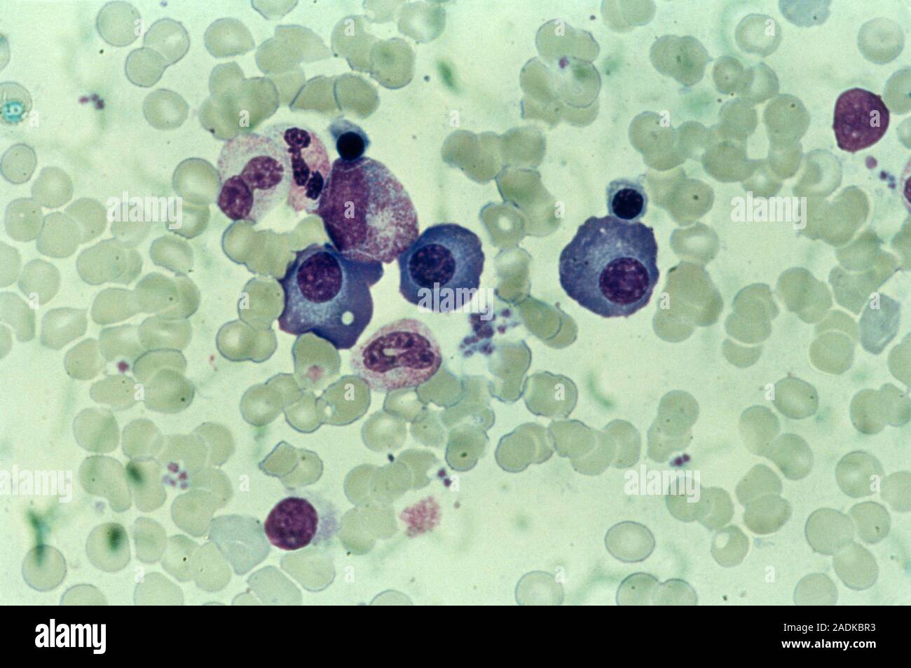 White blood cells. Light micrograph of a blood smear showing white ...
