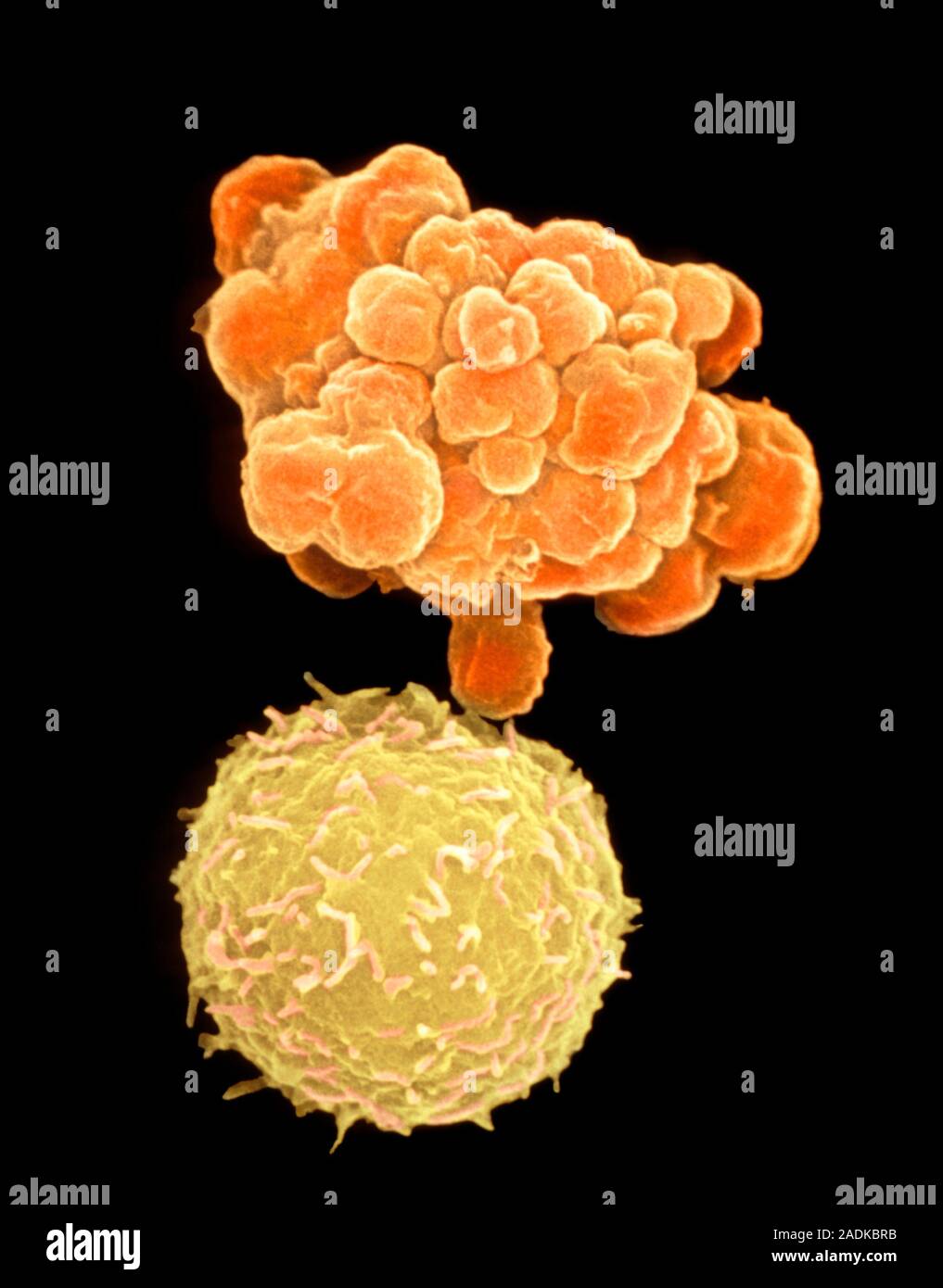 Apoptosis. Scanning electron micrograph (SEM) of human white blood ...