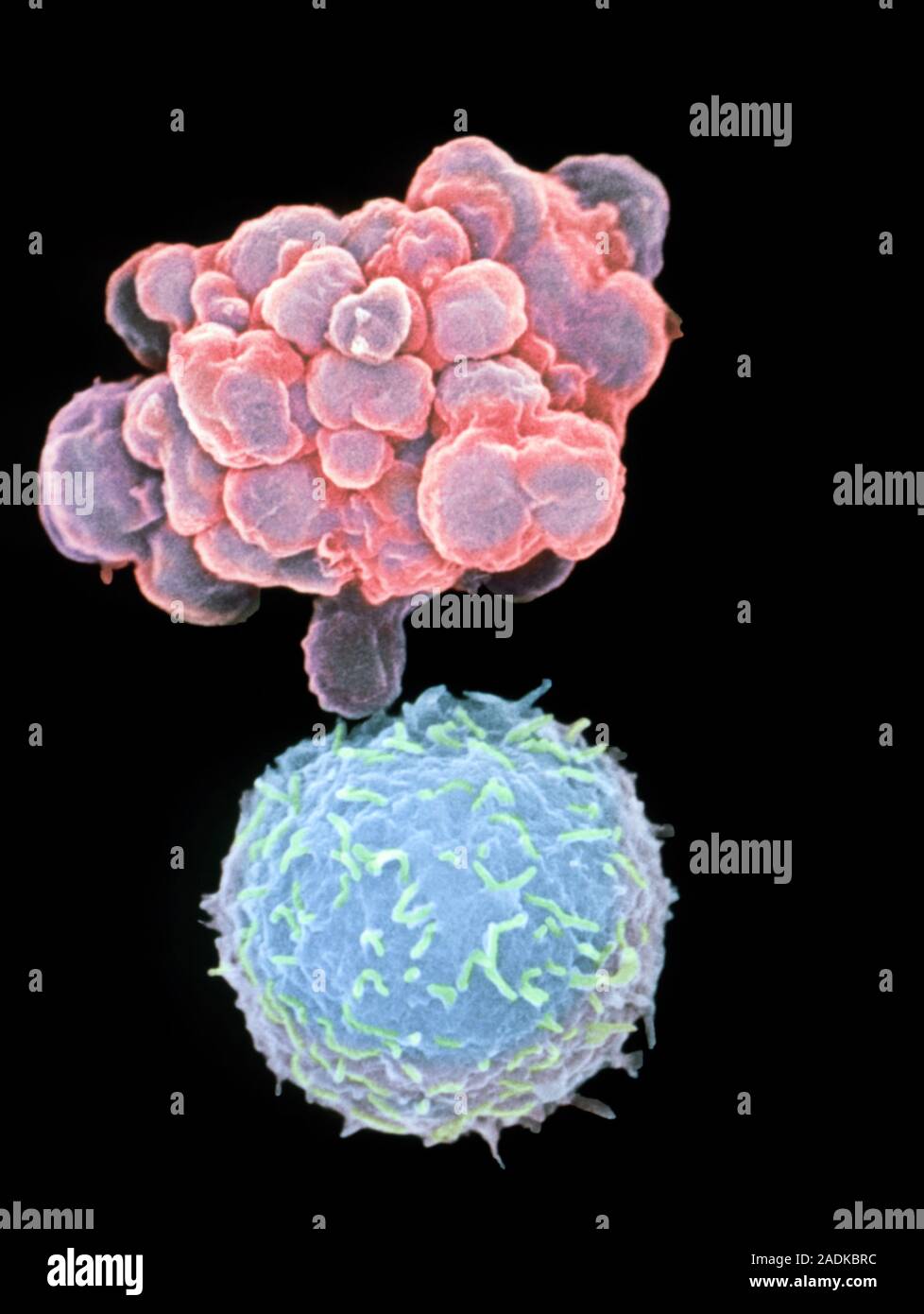 Apoptosis. Coloured scanning electron micrograph (SEM) of human white ...