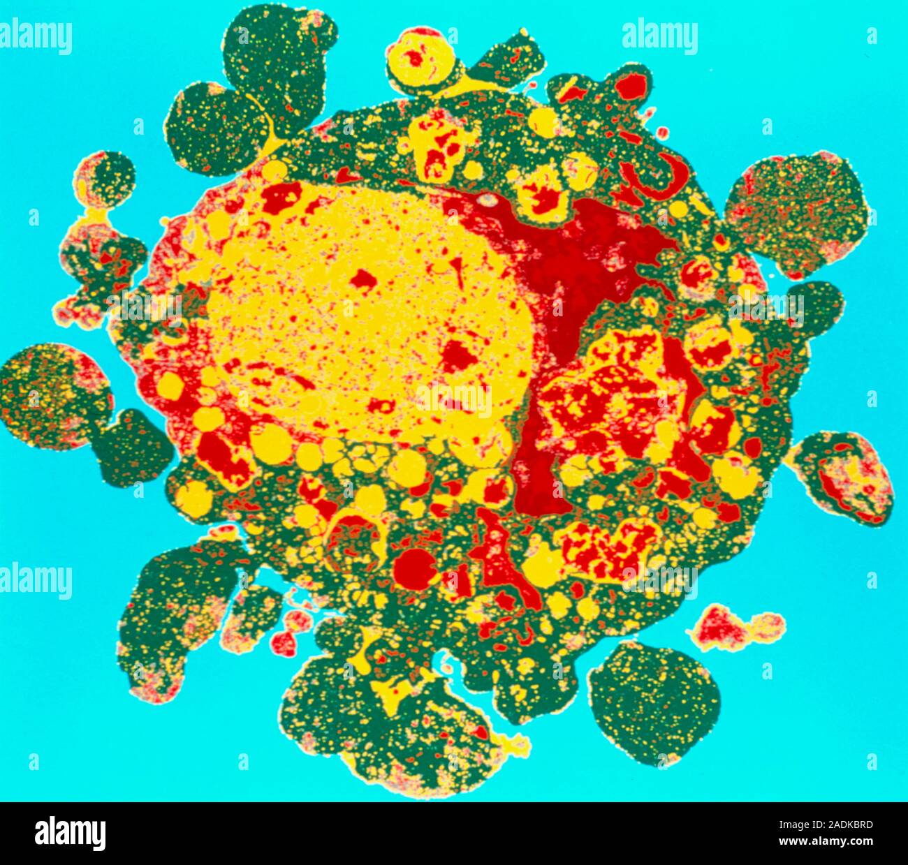 Apoptosis. Coloured transmission electron micrograph (TEM) of a section ...