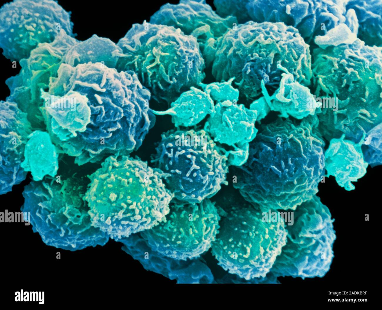 White blood cells & platelets. Coloured scanning electron micrograph ...