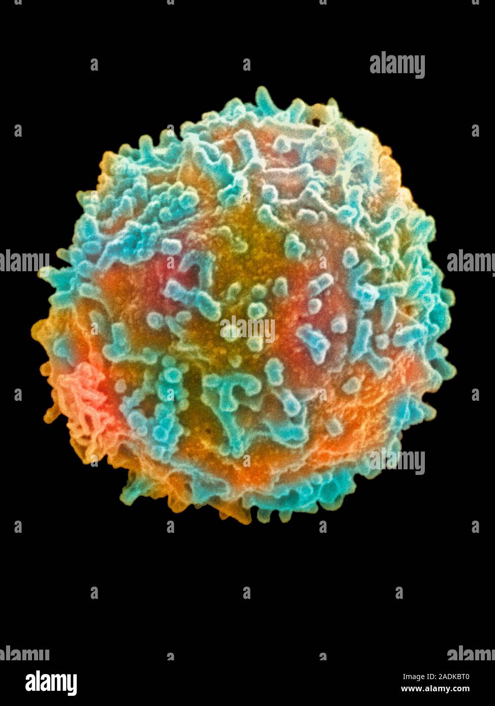 Lymphocyte blood cell. Coloured scanning electron micrograph (SEM) of a ...