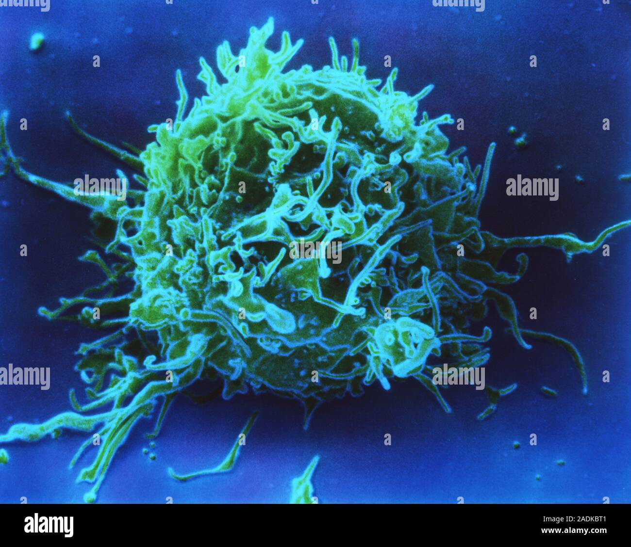 White blood cell. Coloured scanning electron micrograph (SEM) of a ...