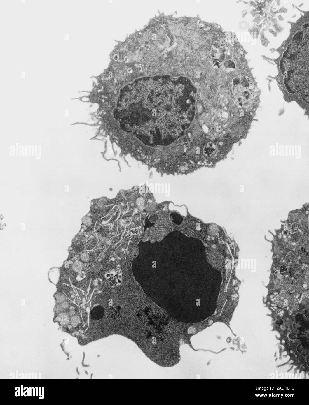 Apoptosis. Transmission electron micrograph (TEM) of a section through ...