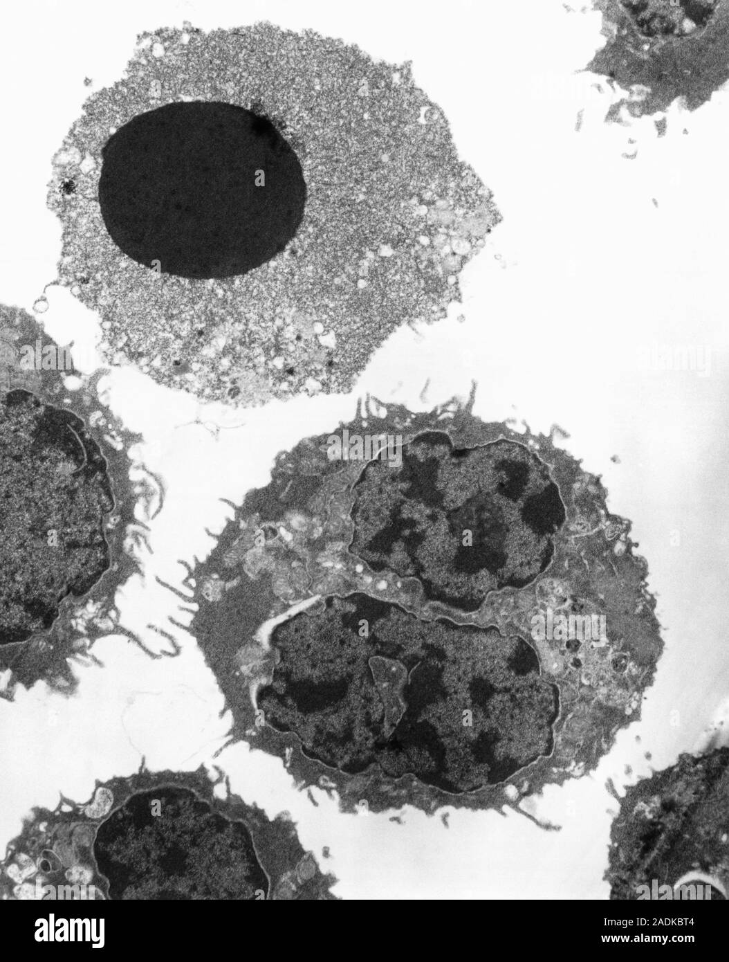 Apoptosis. Transmission electron micrograph (TEM) of a section through ...