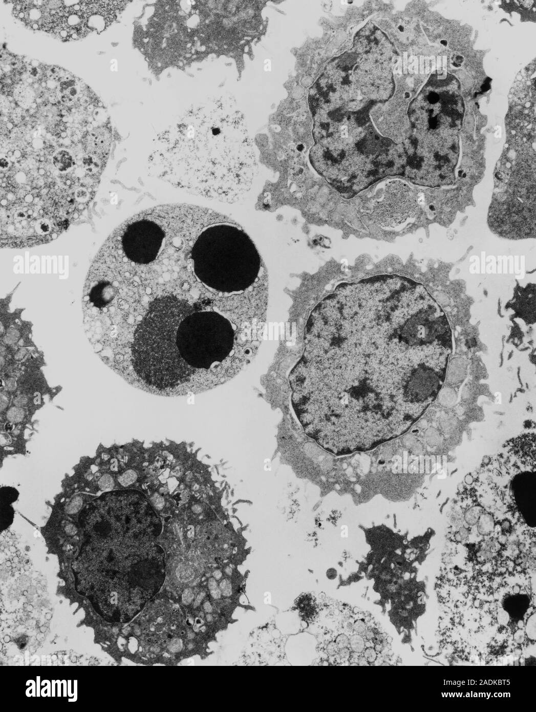 Apoptosis. Transmission electron micrograph (TEM) of a section through ...