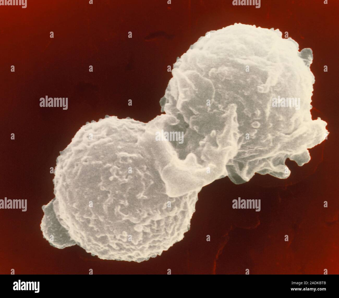 White blood cells. Coloured scanning electron micrograph of two ...