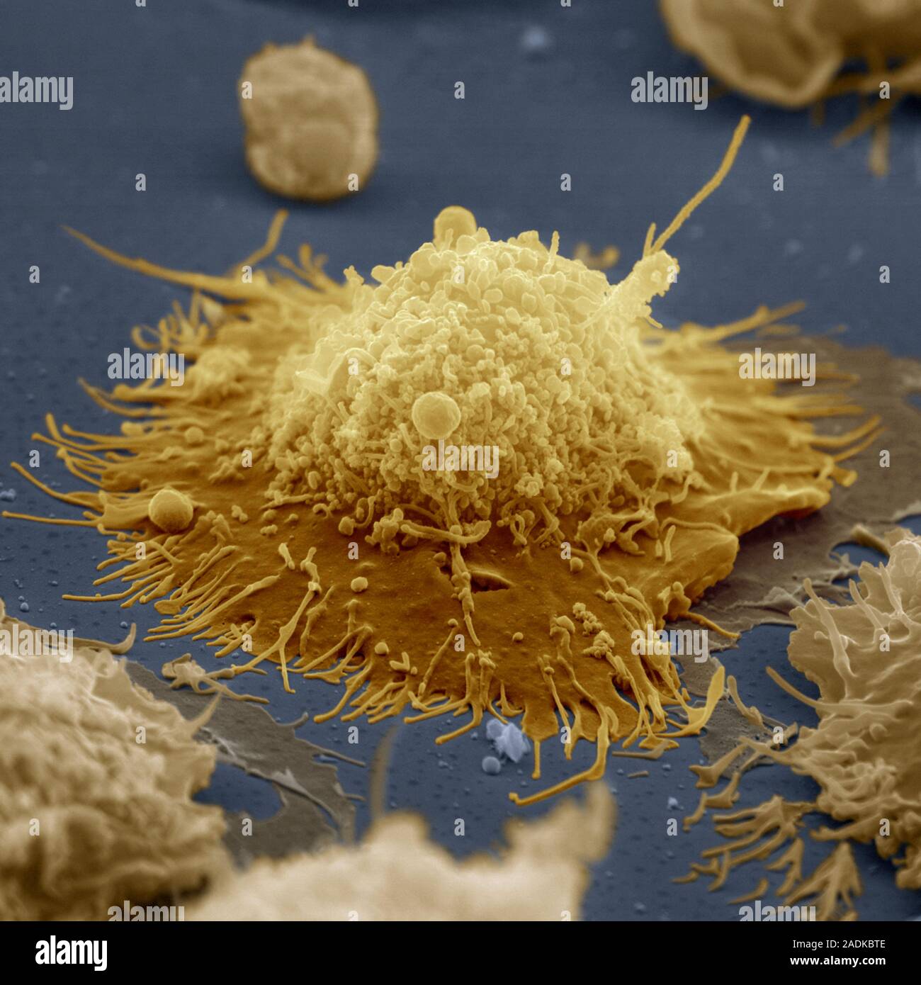 B-lymphocyte white blood cell. Coloured scanning electron micrograph ...