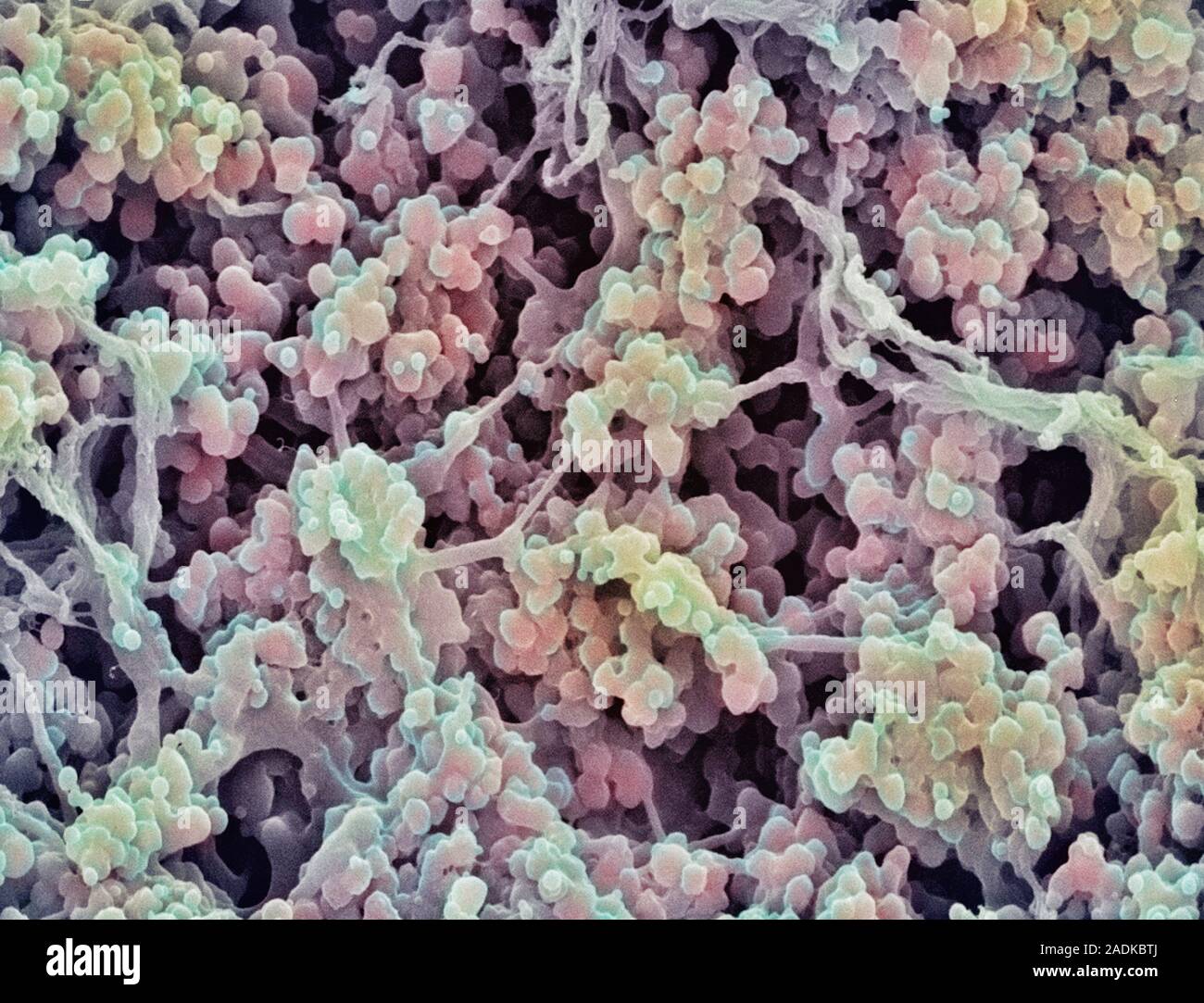 White blood cells. Colour scanning electron micrograph (SEM) of T ...