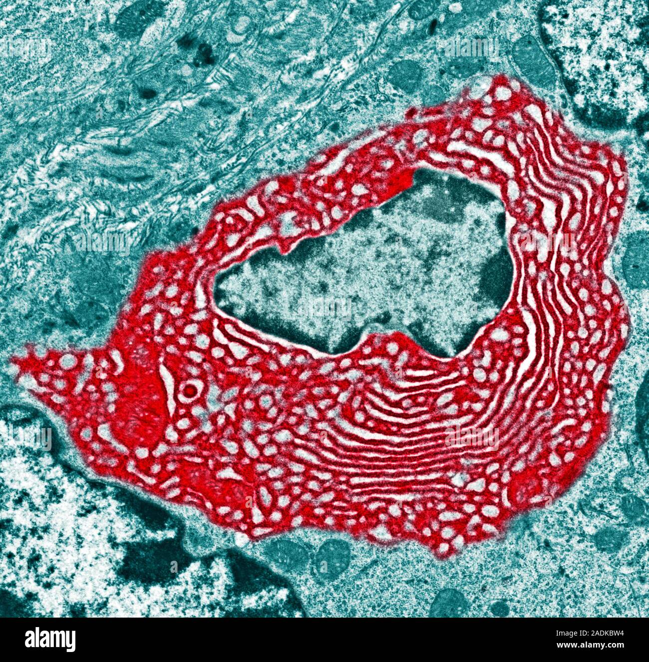 Plasma cell. Coloured transmission electron micrograph of a plasma cell ...