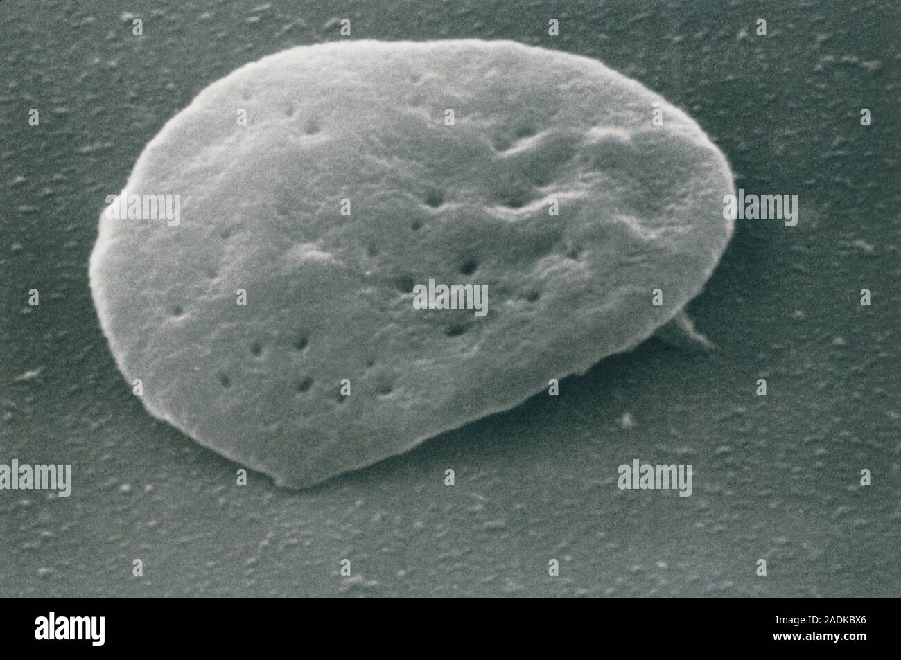 Scanning electron micrograph of an unactivated blood platelet ...