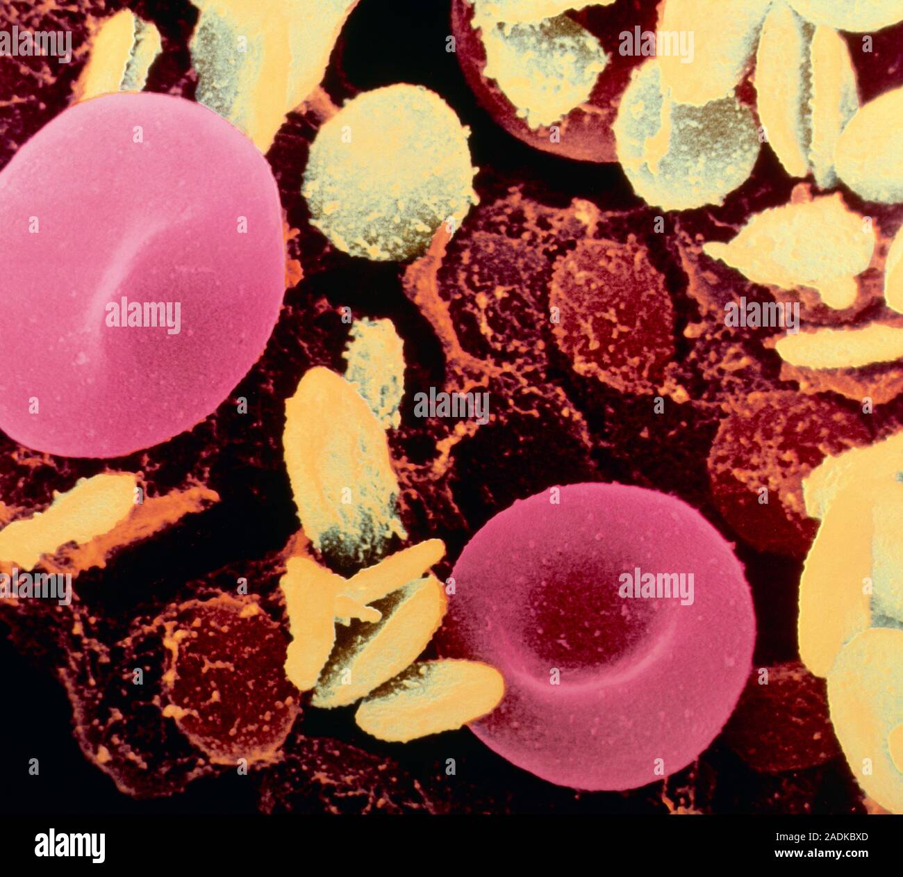 False-colour scanning electron micrograph (SEM) of unactivated blood ...