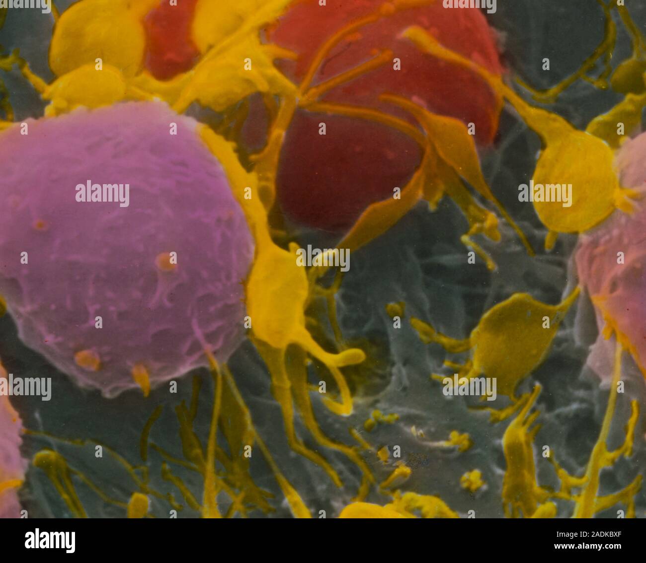 Activated platelets. Coloured Scanning Electron Micrograph (SEM) of ...