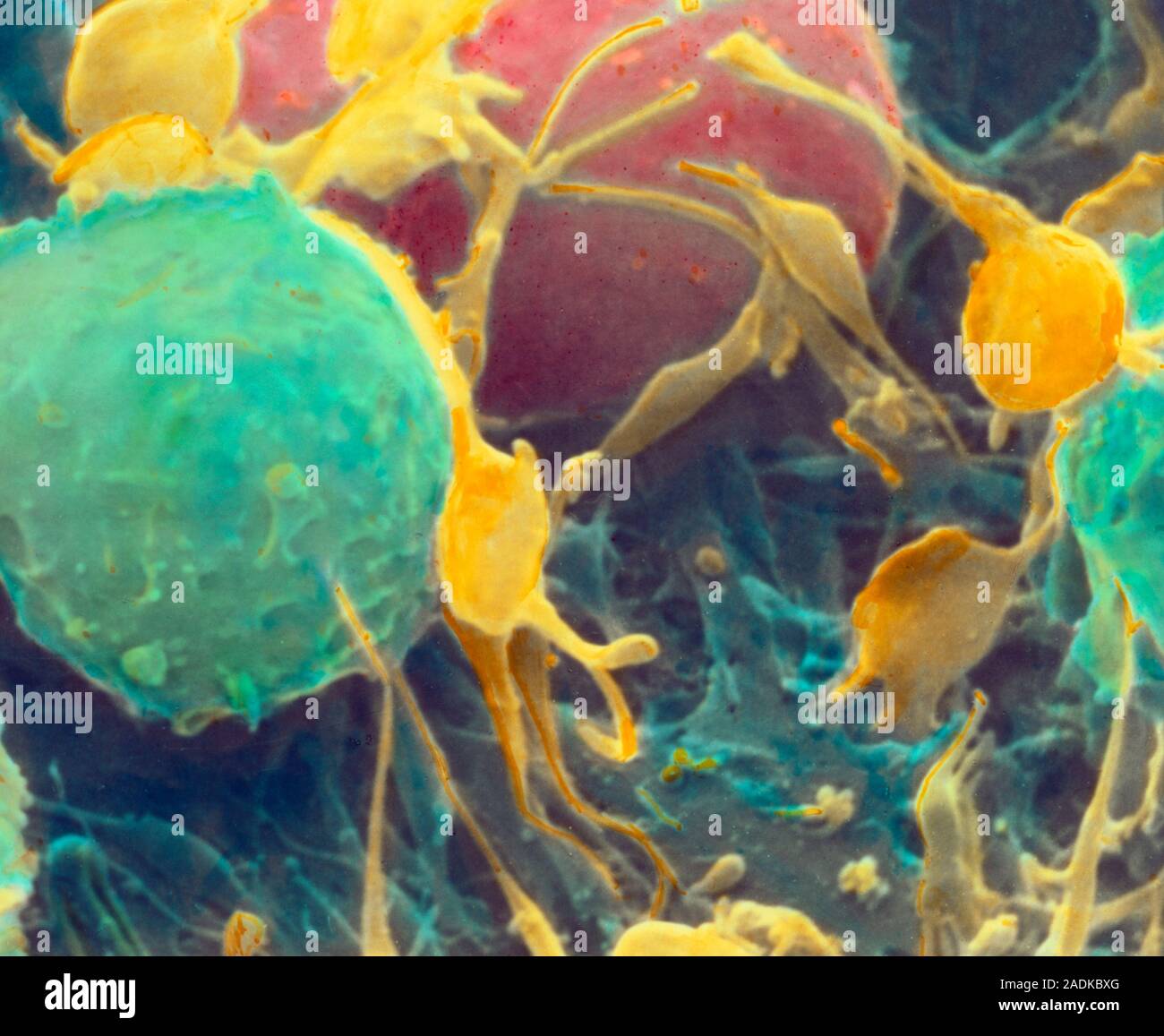 Activated platelets. Coloured Scanning Electron Micrograph (SEM) of ...