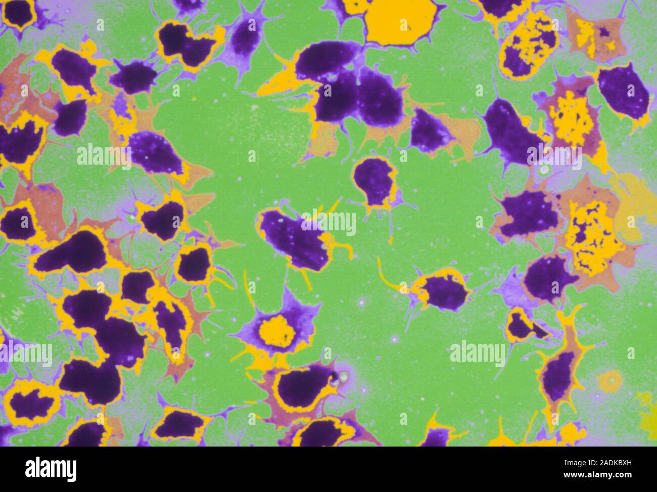 Platelets. Coloured transmission electron micrograph (TEM) of a section ...