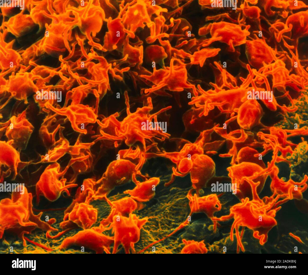 Activated platelets. Coloured scanning electron micrograph of activated ...