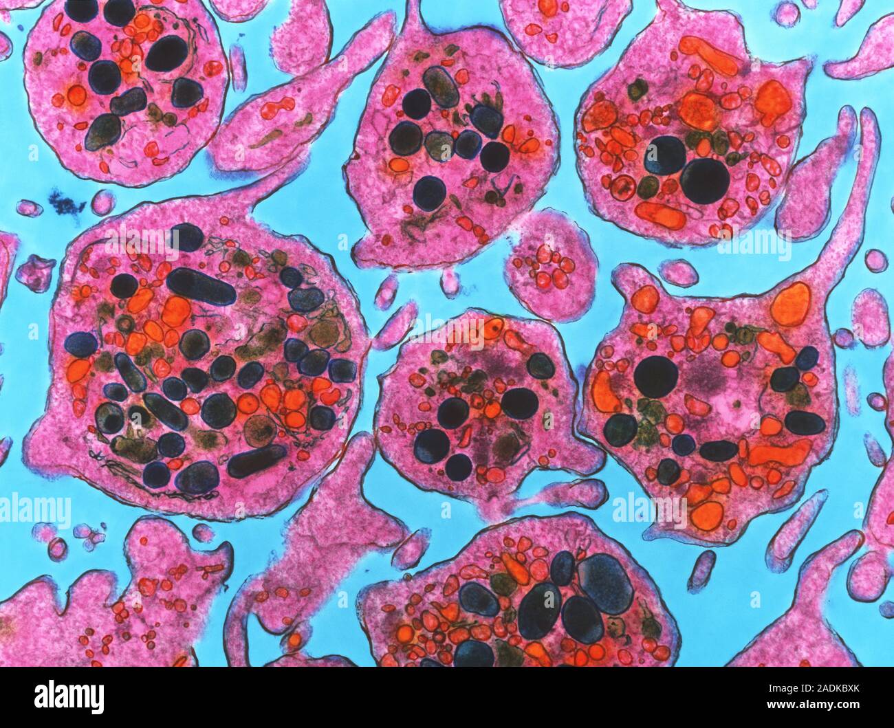 Active platelets. Coloured transmission electron micrograph (TEM) of a ...