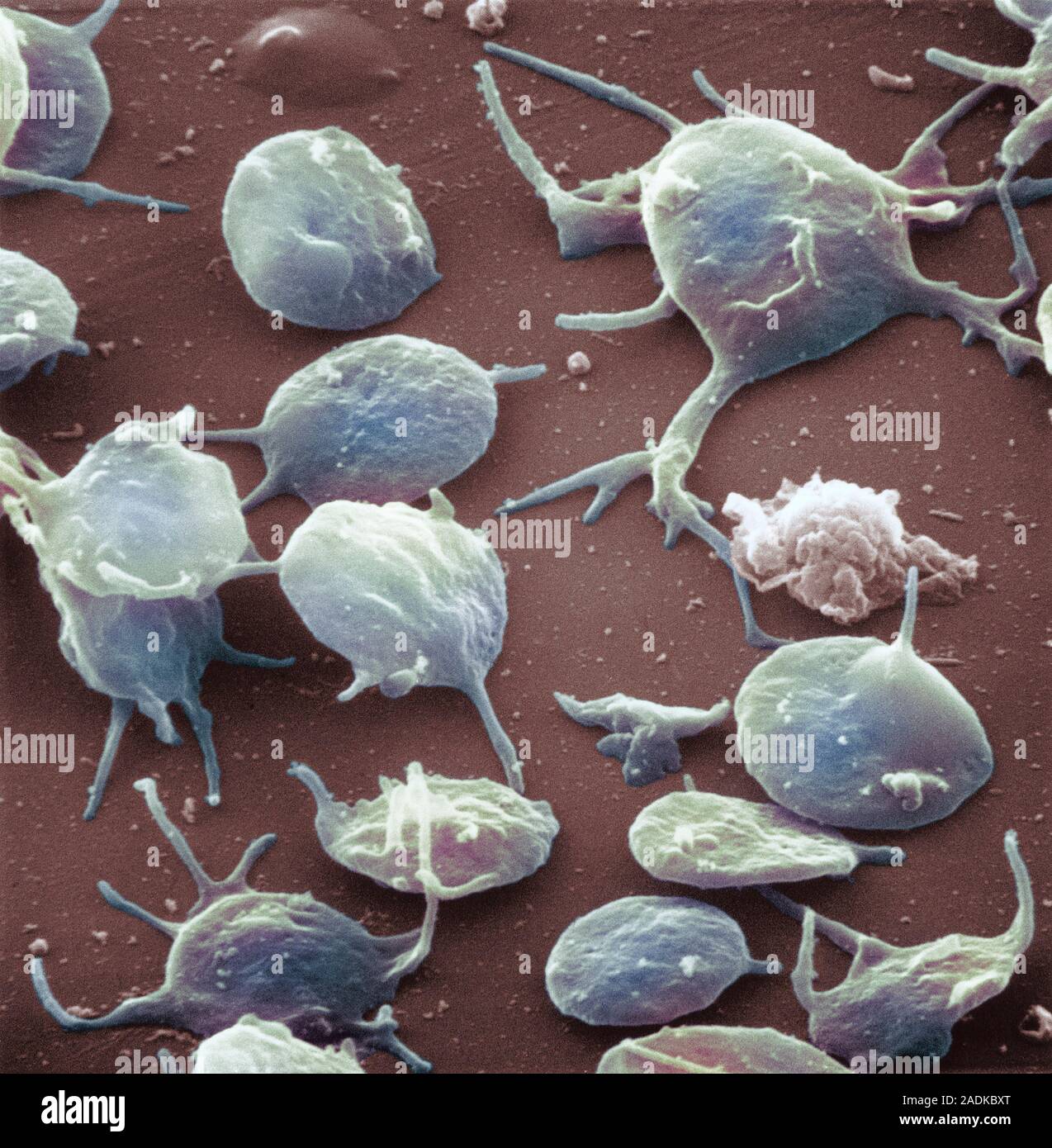 Blood platelets. Coloured scanning electron micro- graph (SEM) of activated blood platelets ...