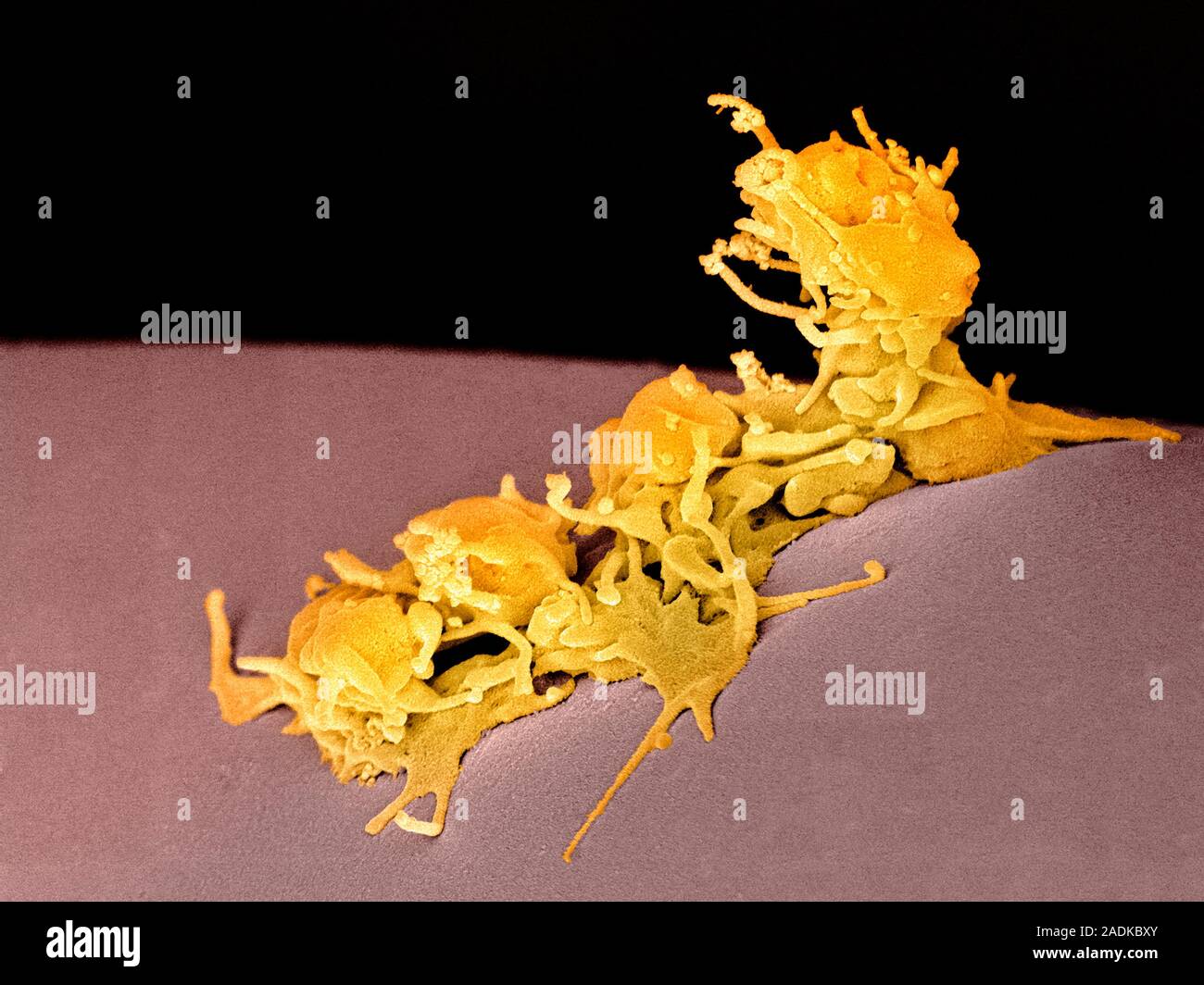 Activated platelets growing on a filter, coloured scanning electron ...