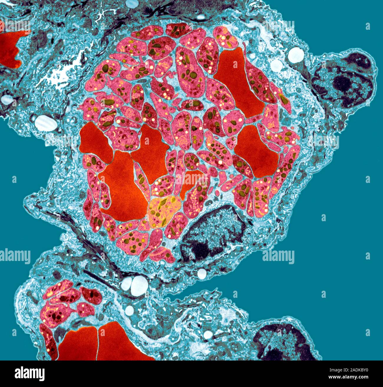 Active platelet. Coloured transmission electron micrograph (TEM) of a ...