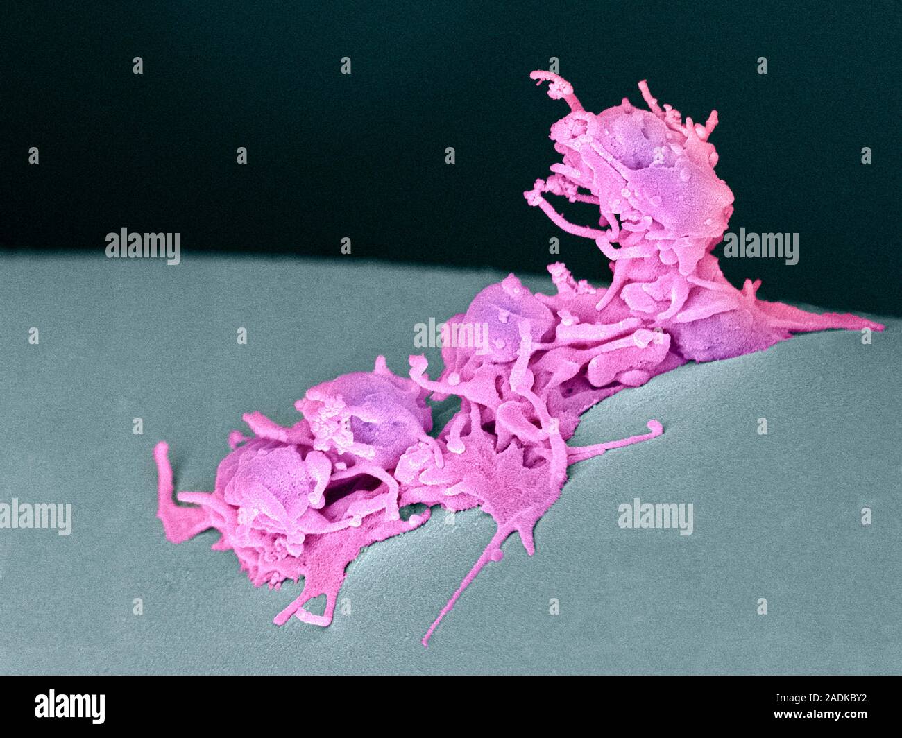 Activated platelets growing on a filter, coloured scanning electron ...