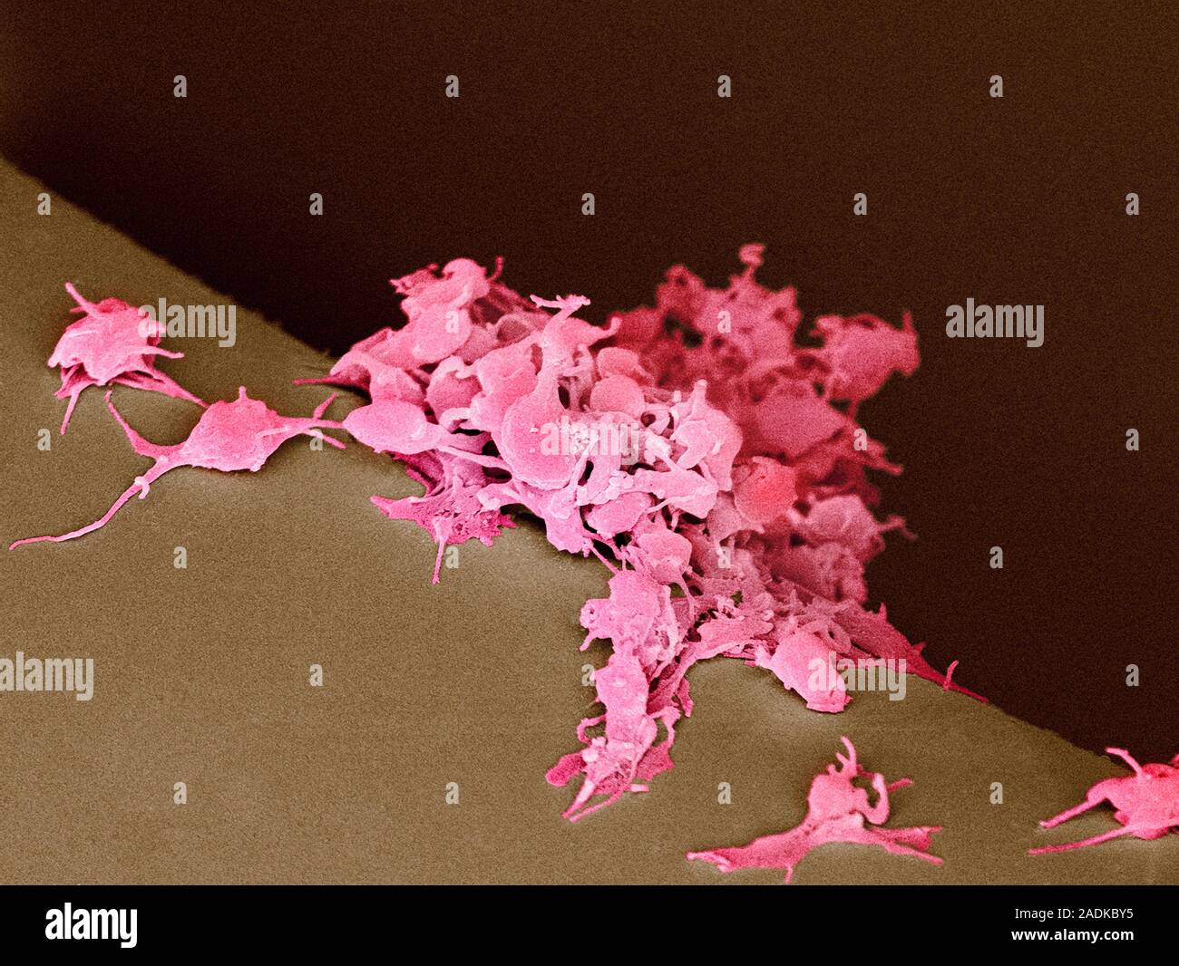 Activated platelets growing on a filter, coloured scanning electron ... Activated platelets growing on a filter, coloured scanning electron ...