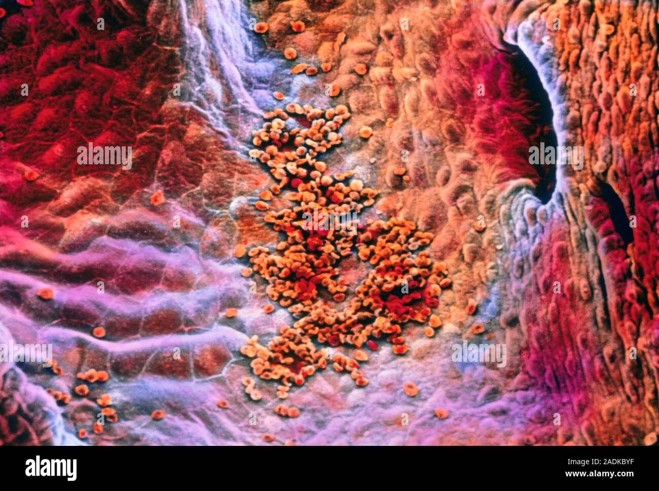 Early stage of blood clot formation: false-colour scanning electron ...