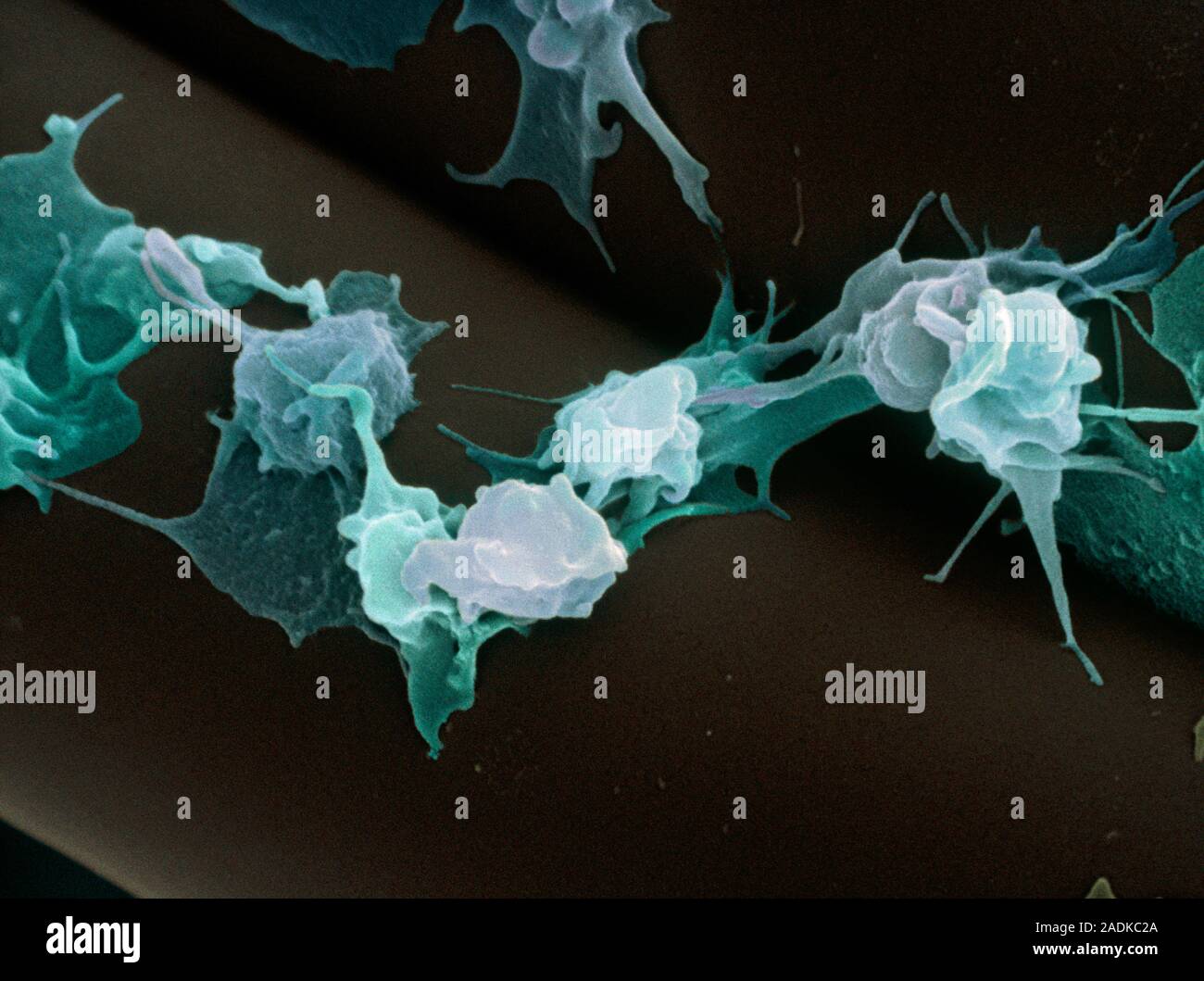 Activated platelets. Coloured scanning electron micrograph (SEM) of ...