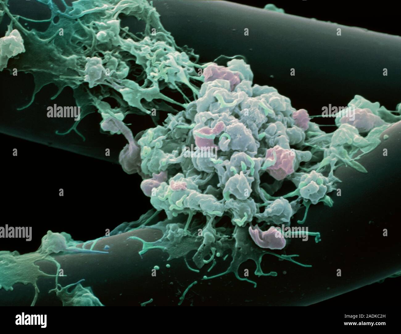 Activated platelets. Coloured scanning electron micrograph (SEM) of ...