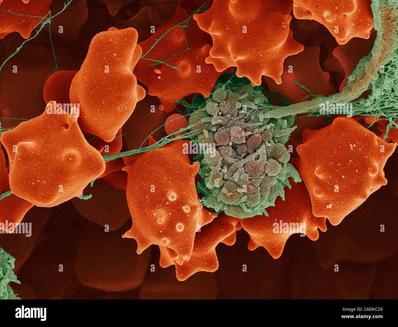 Blood clot. Coloured scanning electron micrograph (SEM) of a small ...