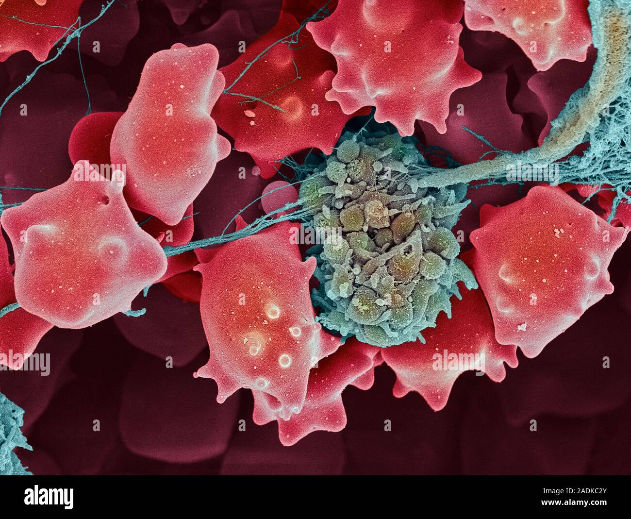 Blood clot. Coloured scanning electron micrograph (SEM) of a small ...